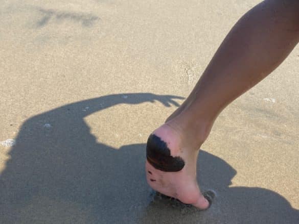 Two Ways to Remove Beach Tar From Your Feet - JohnnyJet.com